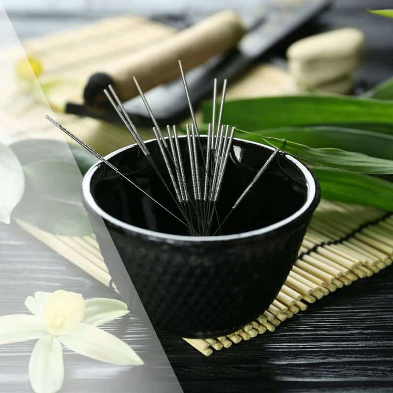 Acupuncture Offers Hope for Diabetes Management » Nature's Wisdom ...